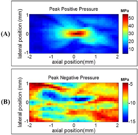 Positive Polarity Pulse Pressure Fields 2d Spatial Pressure Fields