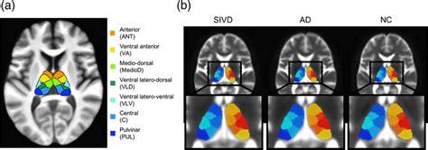 A Segregated Thalamic Subregions Used In This Study B The Final