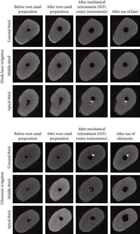 Micro Ct Shows The Crack Formation And Propagation In The Same Slice At Download Scientific