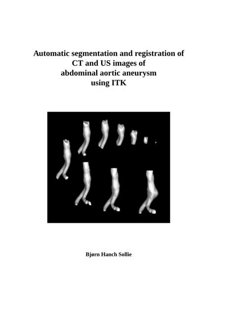 Pdf Automatic Segmentation And Registration Of Ct And Us Bhsaaa