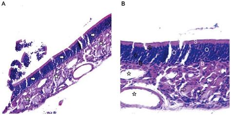 Olfactory Mucosa Location