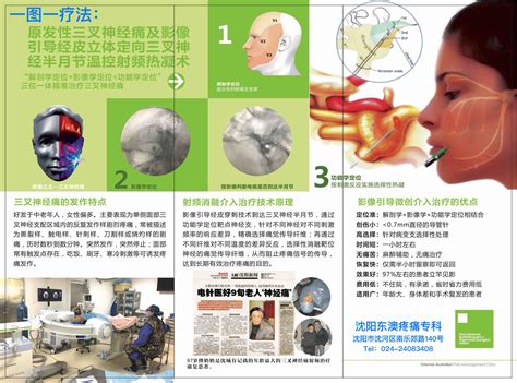 一图一疗法三叉神经半月节温控射频热凝术治疗三叉神经痛 倪忠阁 副主任医师 爱问健康