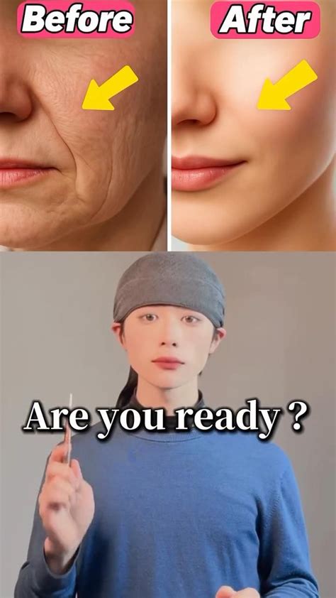 Jaw Bone Loss How To Prevent Facial Bone Loss Artofit