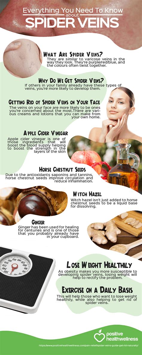What Are Spider Veins And Your Guide To Get Rid Of Them Naturally Artofit