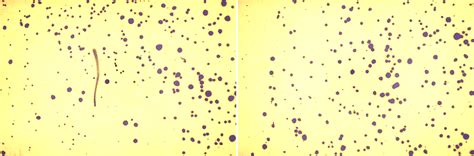 Image Detect Drops Of Water On A Card And Count The Amount And Its Size Opencv C Stack