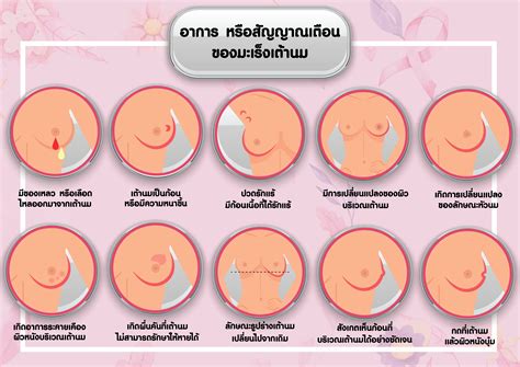 โรงพยาบาลเชียงใหม่ ราม แพทย์ผู้เชี่ยวชาญเฉพาะทางครบทุกสาขา