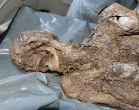 Unknown Corpse In An Advanced State Of Putrefaction Download
