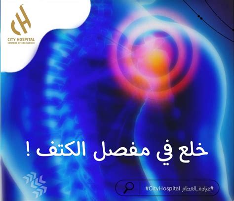 خلع مفصل الكتف ممكن يحصل City Hospital مستشفى سيتي