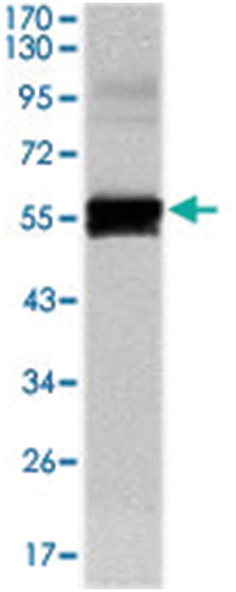 Pax6 Mouse Clone 1c8 Abnova 100μl Unlabeledanticorps Monoclonal