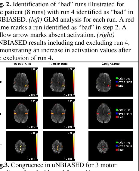 Figure 2 From 5055 Unbiased A Fully Automated Model Free Fmri Analysis