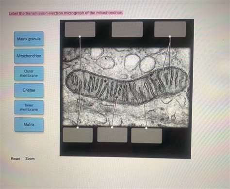 Mitochondria Electron Micrograph Labelled