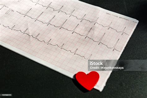 종이 형태의 심전도를 클로즈업 하 여 목 제 심장 심전도 또는 검정색 배경에 Ekg 종이 의료 및 의료 개념 개념에 대한 스톡
