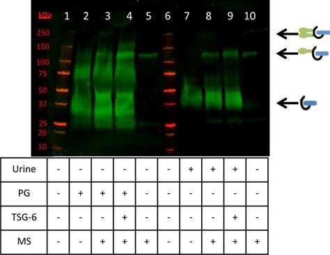 Transferring Heavy Chains To Native Bikunin From Healthy Human Urine Download Scientific