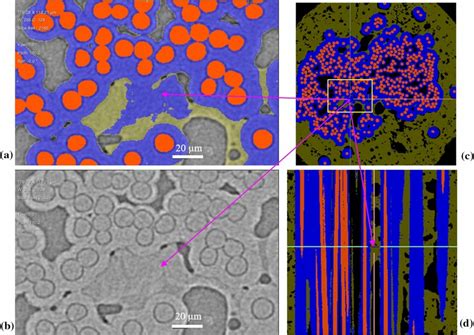 Example Of Incorrect Phase Identification In Automated Segmentation Download Scientific Diagram
