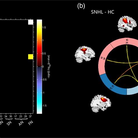 A Matrix Shows Differences Of Internetwork Functional Connectivity Download Scientific