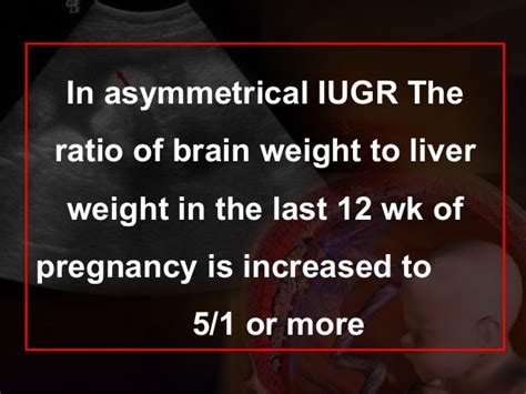 Iugr Vld