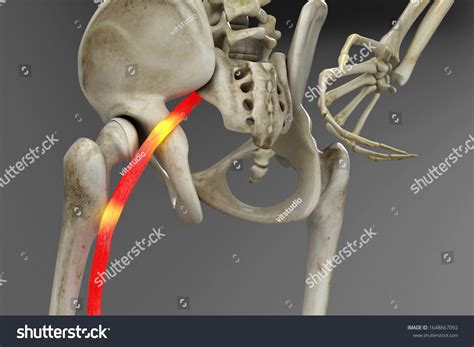 Pinched Human Sciatic Nerve Anatomical Vision Stock Illustration