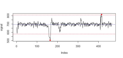 Time Series Conditional Peak And Valley Signal Detection In Realtime