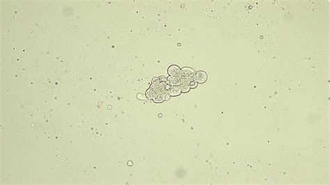 Urine Cells Eclinpath
