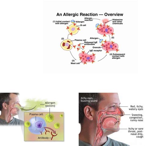 Cause And Risk Factors The Great Big Allergies