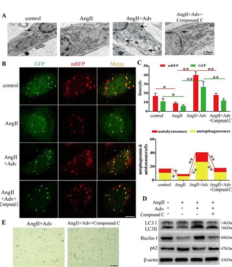 Lncrna P21 Overexpression Enhanced Autophagy Weakened By Angii Through