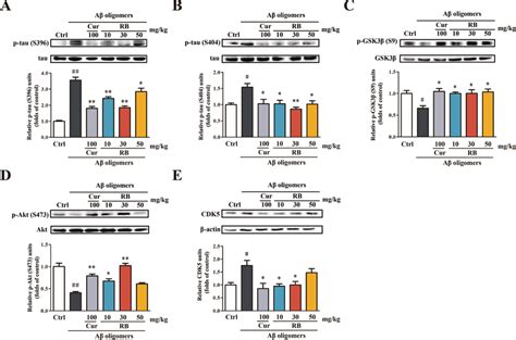 Rb Downregulated Tau Hyperphosphorylation In The Hippocampus Of Aβ
