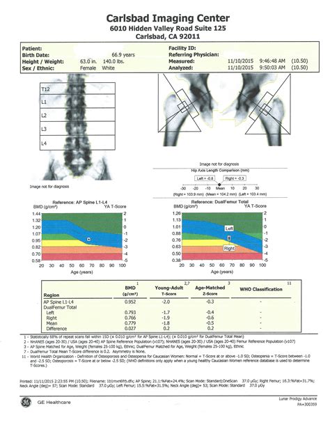 Bone Densitometrydexa Scan Carlsbad Imaging Center Imperial Radiology