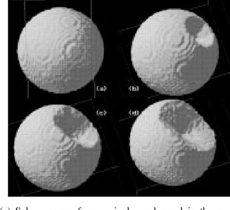 Figure 1 From A Novel Volumetric Feature Extraction Technique With Applications To Mr Images