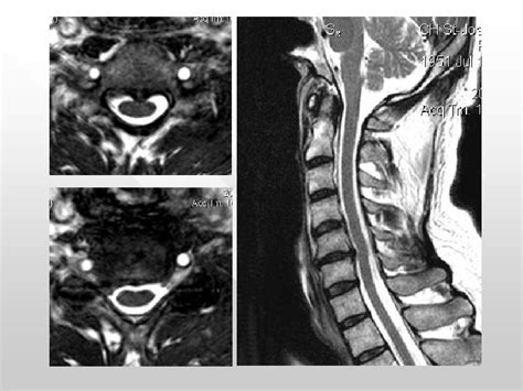 EXPLORATION RADIOLOGIQUE DU RACHIS CERVICAL ET LOMBAIRE Dr