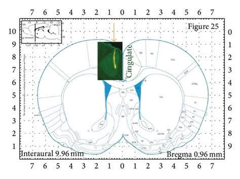 Electrode In The Cingulate Cortex Cg Download Scientific Diagram