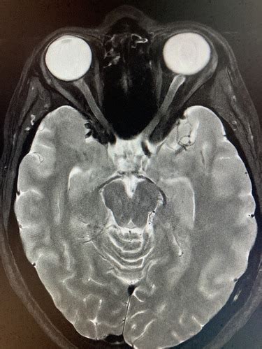 MRI Quiz Week Flashcards Quizlet