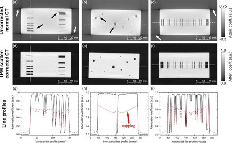 Figure 1 From Scatter Correction Method By Temporal Primary Modulation