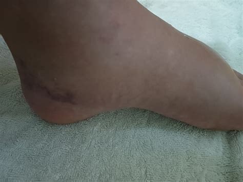 검은사막 인벤 발목 삔 후기약혐 검은사막 인벤 자유게시판