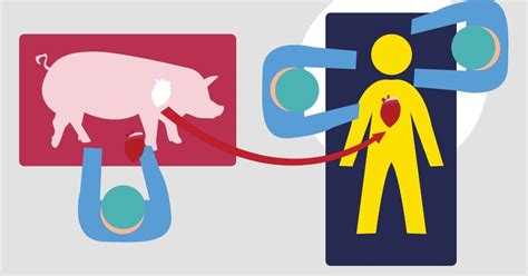 Xenotransplantation Organ Donor