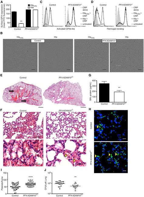 Synergistic Action Of Staphylococcus Aureus α Toxin On Platelets And Myeloid Lineage Cells