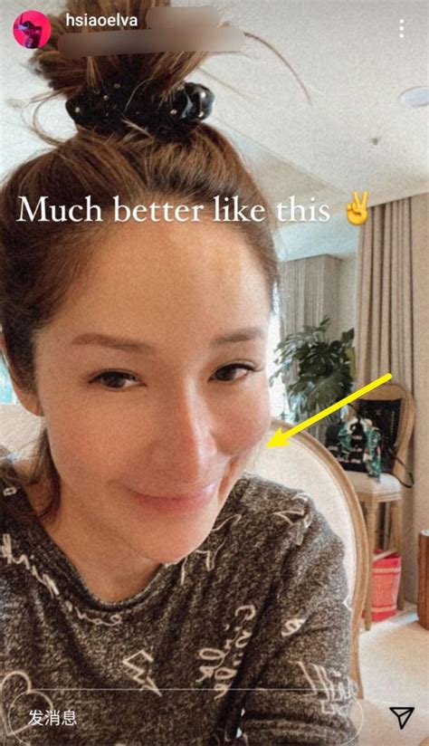 蕭亞軒曬近照左臉超深一個大坑似毀容，仍與大狗嘴對嘴接吻引熱議 每日頭條