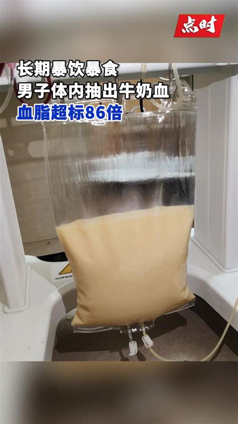 男子甘油三酯超标86倍抽出牛奶血腾讯新闻