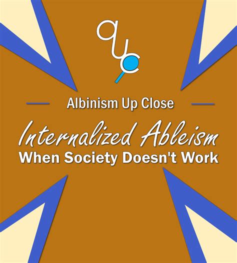 Internalized Ableism When Society Doesnt Work Albinism Up Close