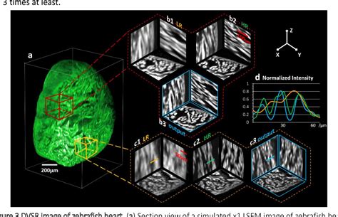 Figure 1 From Deep Learning Light Sheet Fluorescence Microscopy For