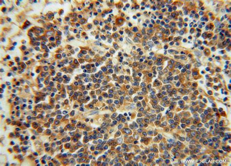 Igg Light Chain Kappa Antibody 14678 1 Ap
