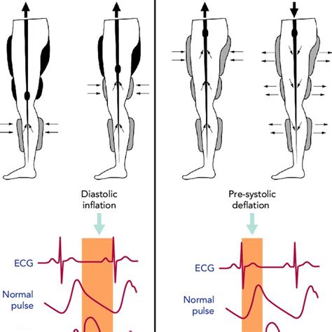 Principles Of External Enhanced Counterpulsation Download Scientific