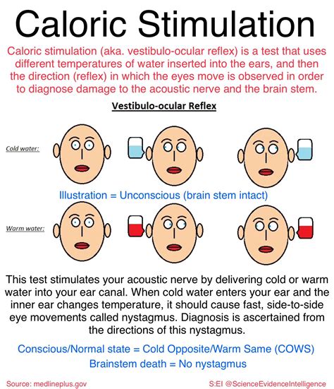 👂🏼what Is Caloric Science Evidence Is Intelligence Facebook