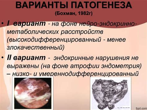 Доброкачественные и злокачественные опухоли женских половых органов