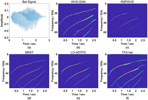 Wvd‐gan A Wigner‐ville Distribution Enhancement Method Based On