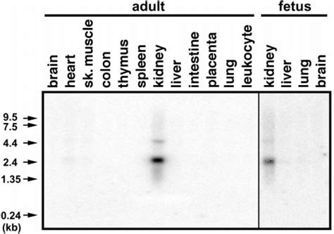 Northern Blot Analysis For Expression Of Nox4 Mrna In Human Tissues