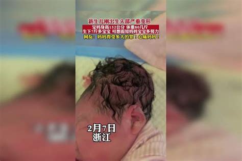 妈妈得受多大的罪 心痛妈妈！