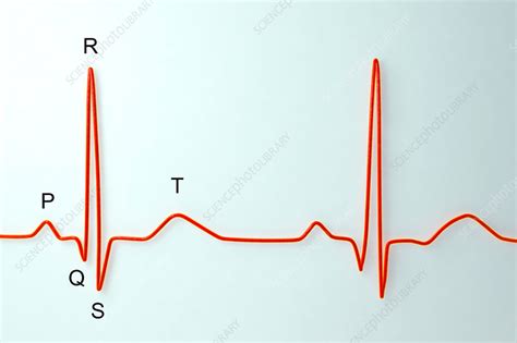 Ecg Illustration Stock Image F019 2510 Science Photo Library