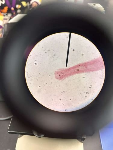 Lab Cestodes Slides Flashcards Quizlet
