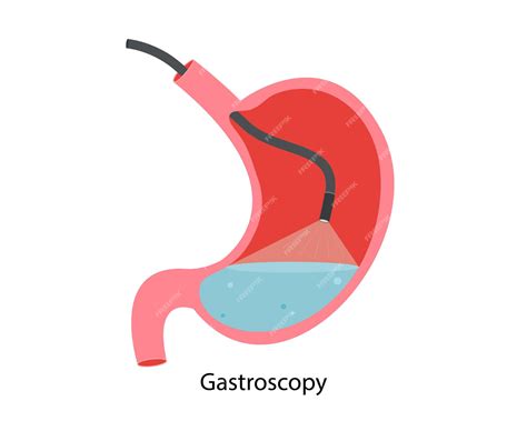 Premium Vector Gastroscopy Procedure Research Of A Stomach