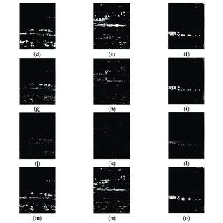 Comparative Experiment Of BHPF MA OTSU Segmentation Algorithm With